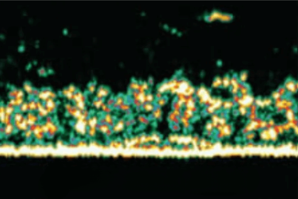 Buy Taut Intense Transformation Program for Better Skin